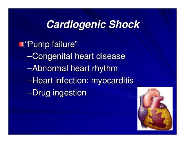 Types of shock in pediatrics