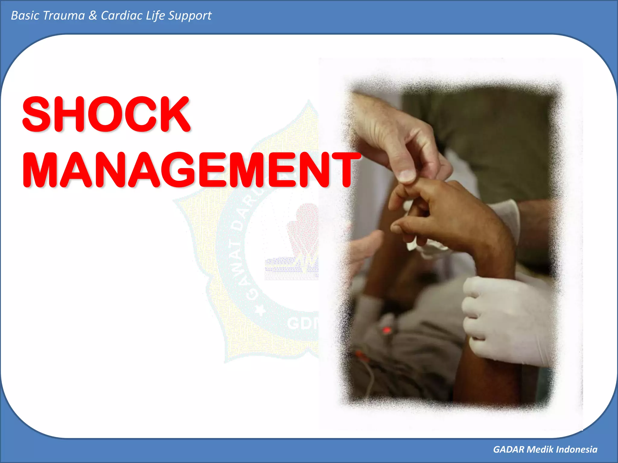 SHOCK MANAGEMENT | PDF