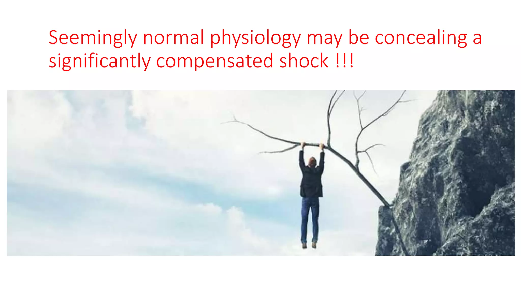 Shock management | PPT