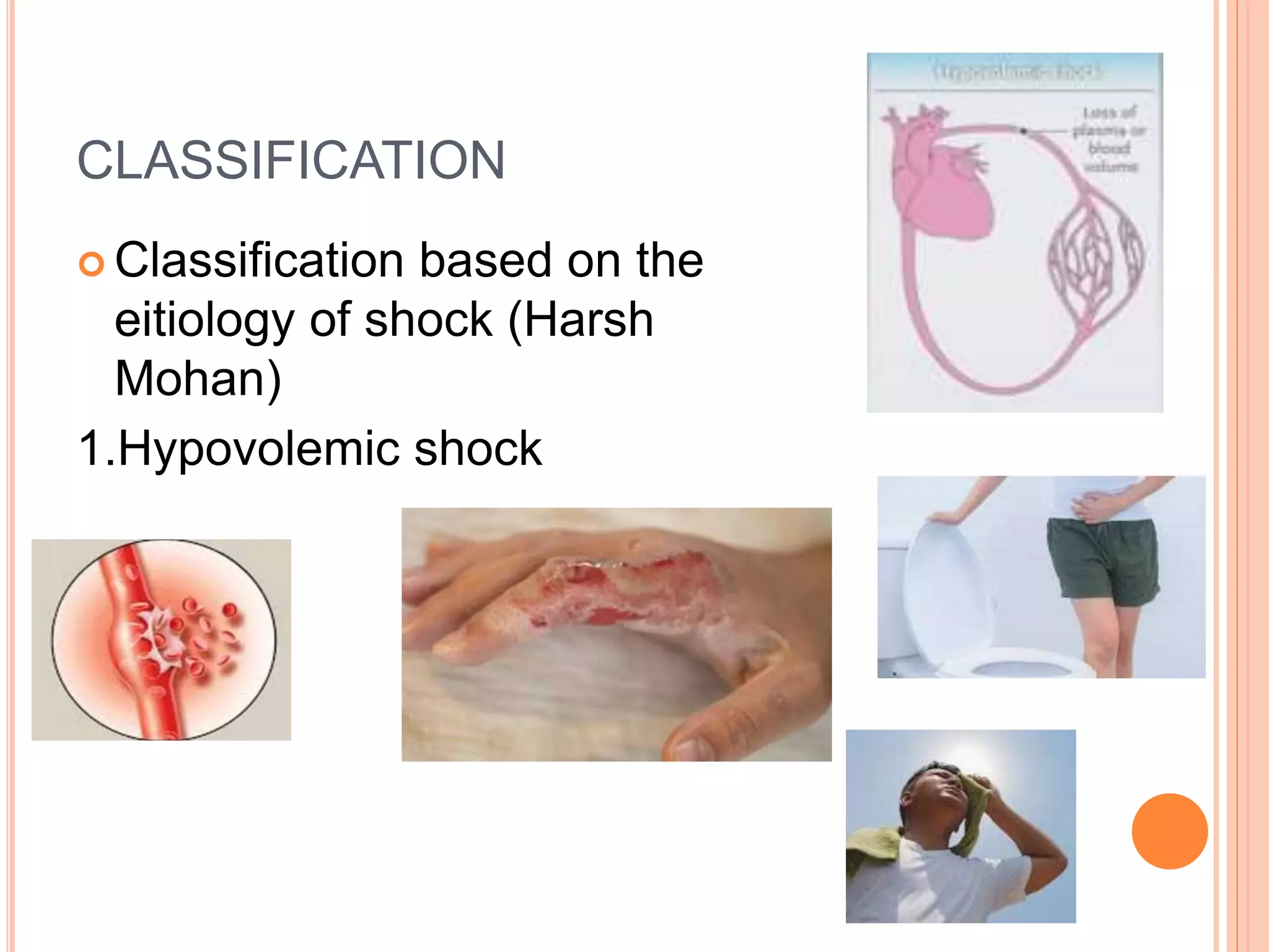 Shock (Circulatory shock) | PPTX
