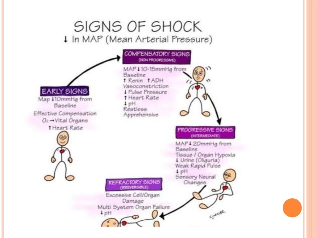 Shock (Circulatory shock)