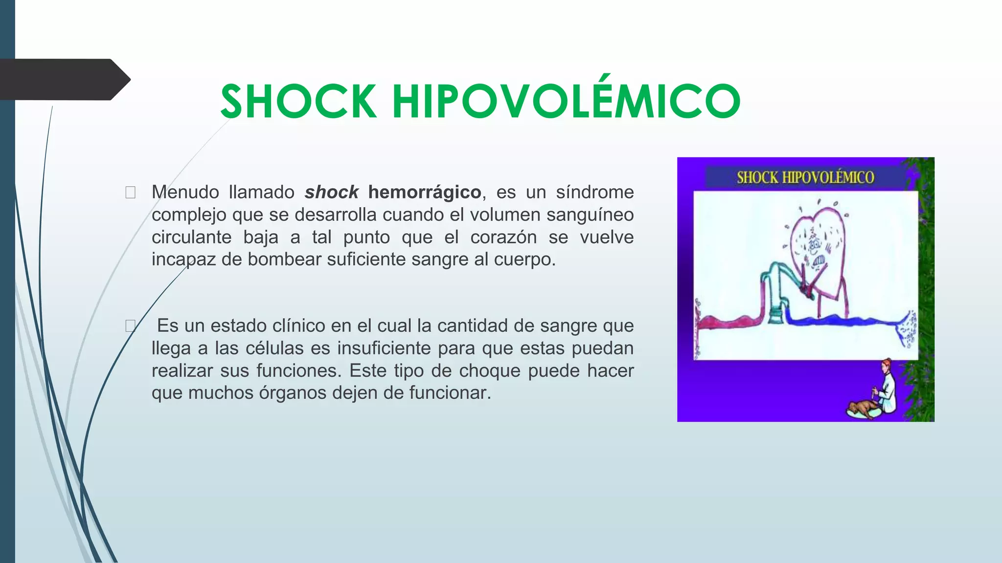 SHOCK HIPOVOLÉMICO | PPTX