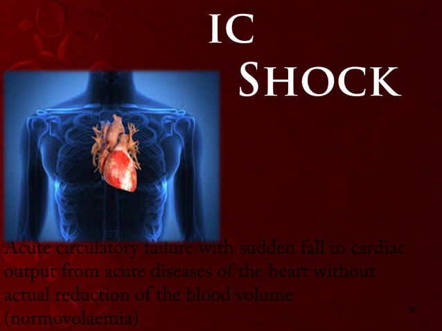 PATHOLOGY AND MANAGEMENT OF SHOCK | PPT