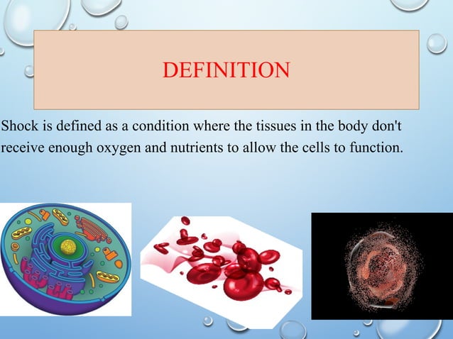 shock ppt.pptx ghfjv sajgkmmhvchtdchvfcng | PPT