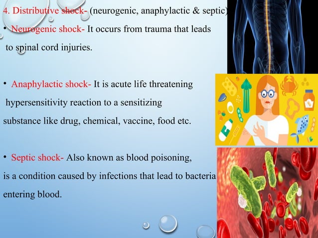 shock ppt.pptx ghfjv sajgkmmhvchtdchvfcng | PPT