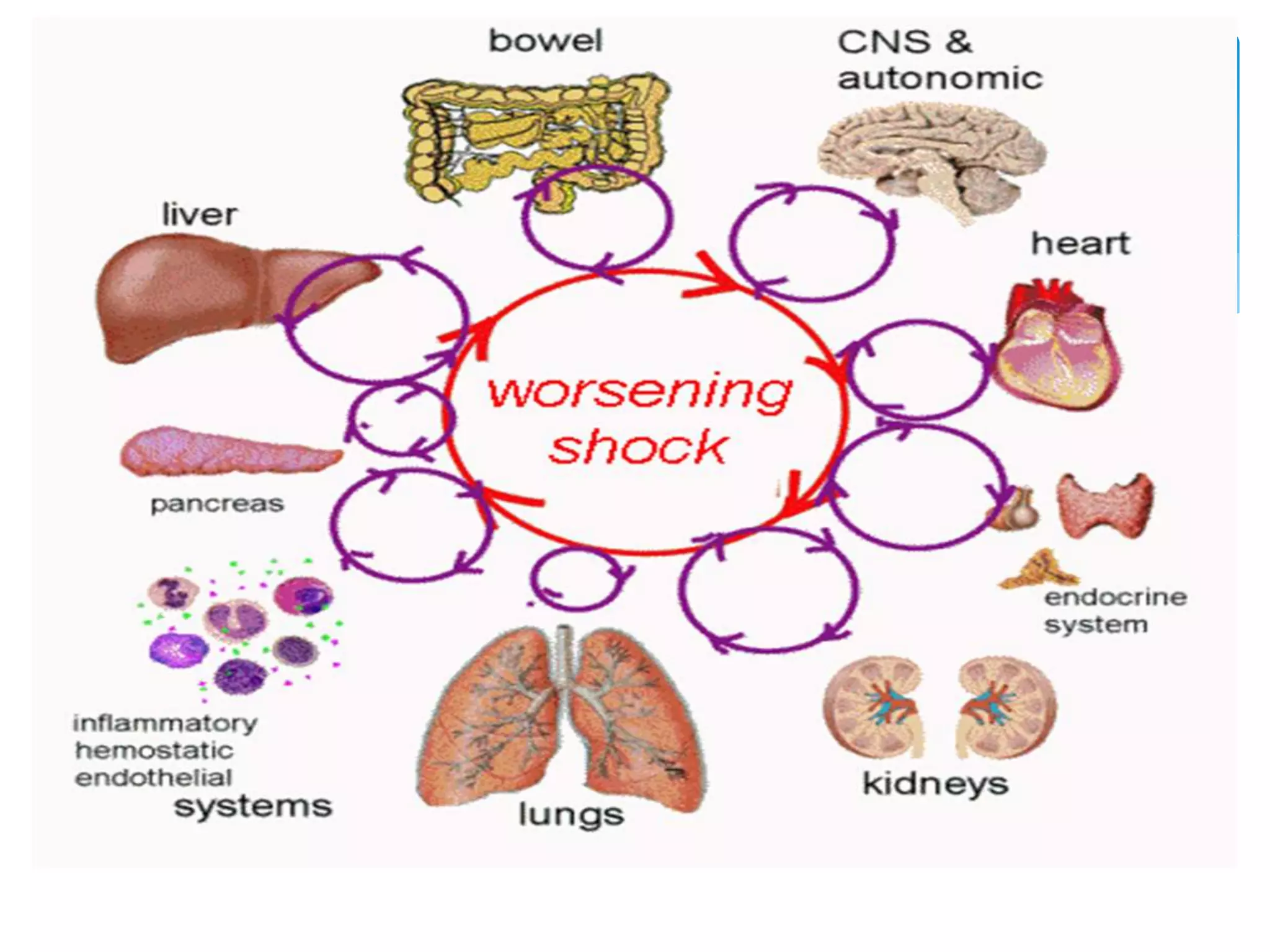 Shock its types and management | PPTX
