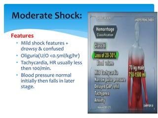 Shock its types and management | PPTX