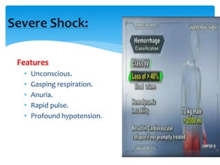 Shock its types and management | PPTX