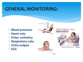 Shock its types and management | PPTX