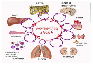 Shock its types and management | PPTX