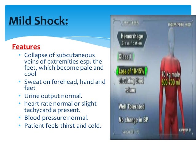 Shock its types and management