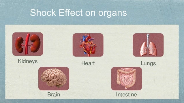 Effects of shock