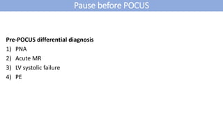 Shock, respiratory failure, and a chest xray | PPTX
