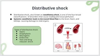 introduction to Shock , understanding of types of shock | PPTX