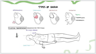 introduction to Shock , understanding of types of shock | PPTX