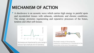Shockwave therapy | PPTX