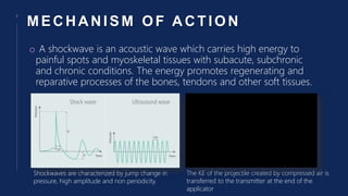 Shockwave therapy Animated presentation | PPTX