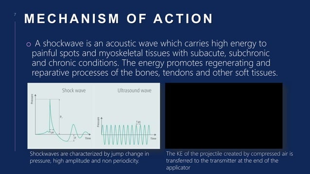 Shockwave therapy Animated presentation | PPTX | First Aid | Injuries