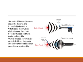 Shockwave Therapy in faster recovery.pptx