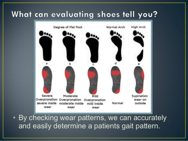 Shoe Types and Anatomy