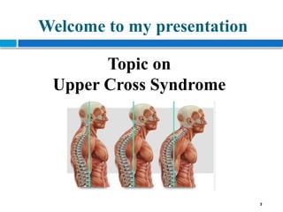 UPPER CROSS SYNDROME DIAGNOSIS AND MANAGEMENT | PPTX
