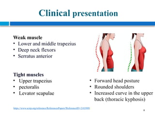 UPPER CROSS SYNDROME DIAGNOSIS AND MANAGEMENT | PPTX