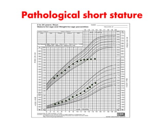 Short Stature | PPTX