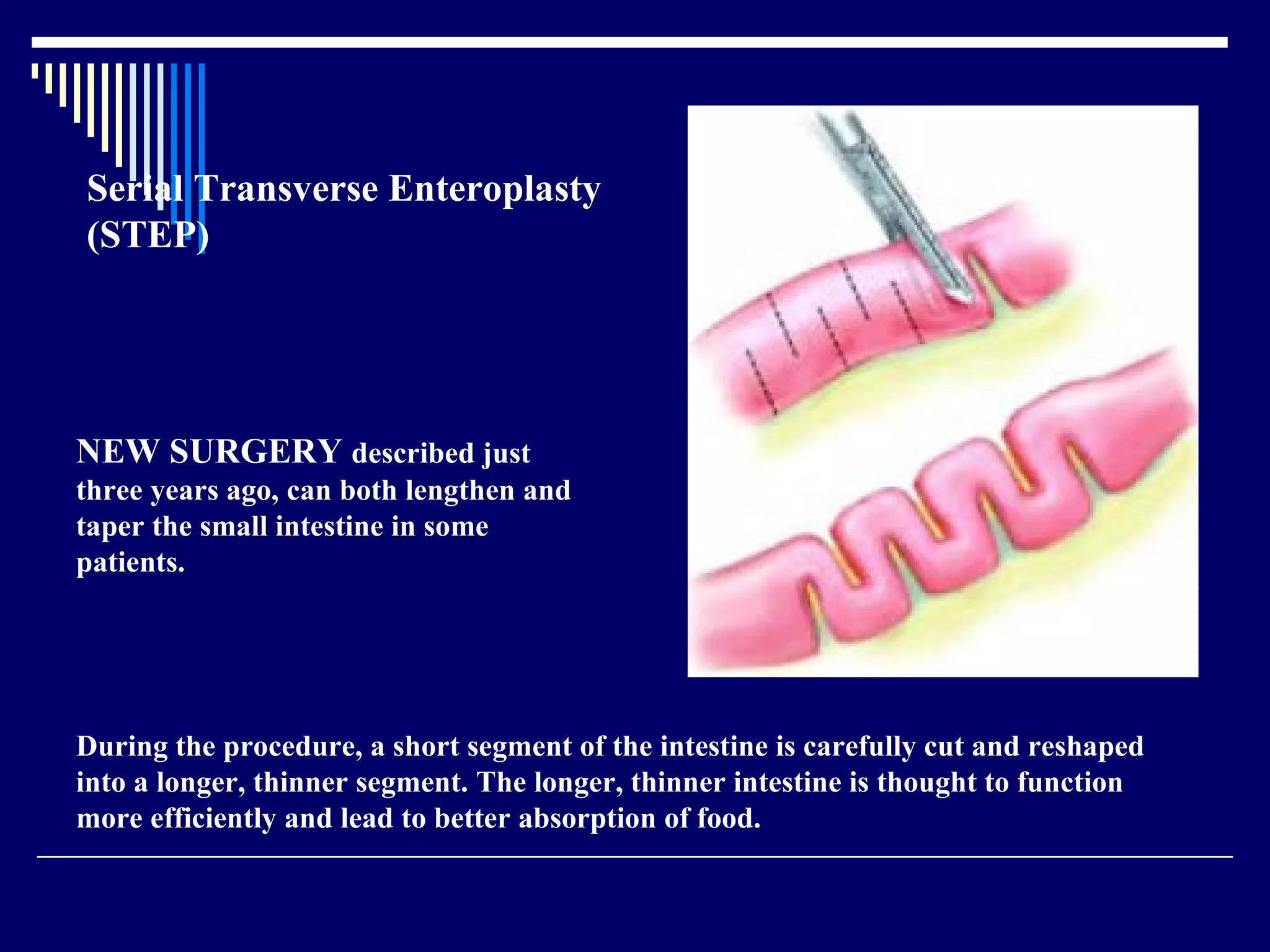 Short Bowel Syndrome | PPT