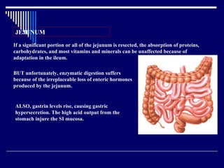 Short Bowel Syndrome | PPT