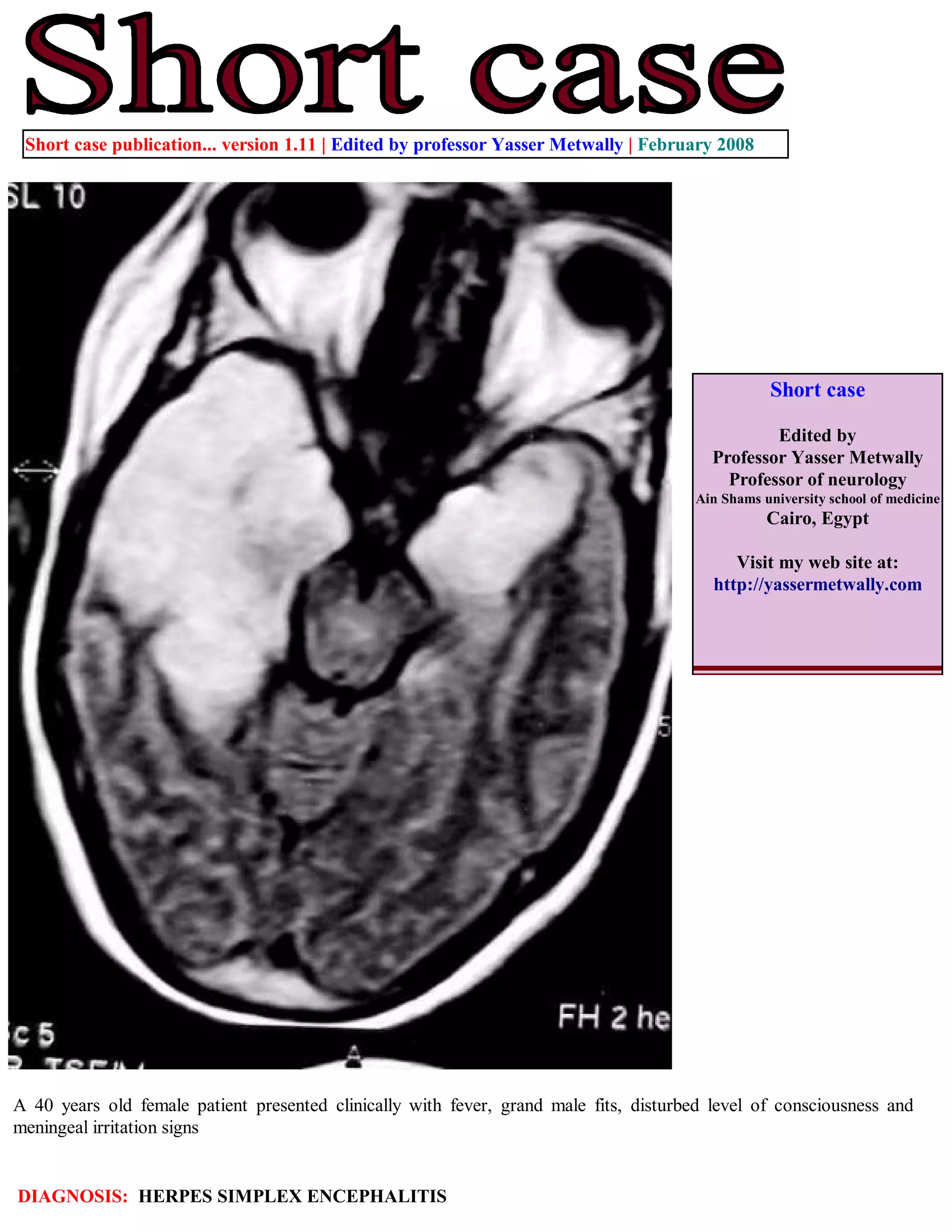 Short case...Herpes encephalitis | PDF