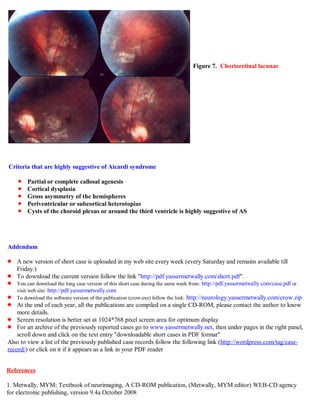 Short case...Aicardi syndrome | PDF