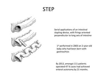 Short bowel syndrome | PPTX