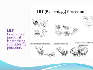 Short bowel syndrome | PPTX