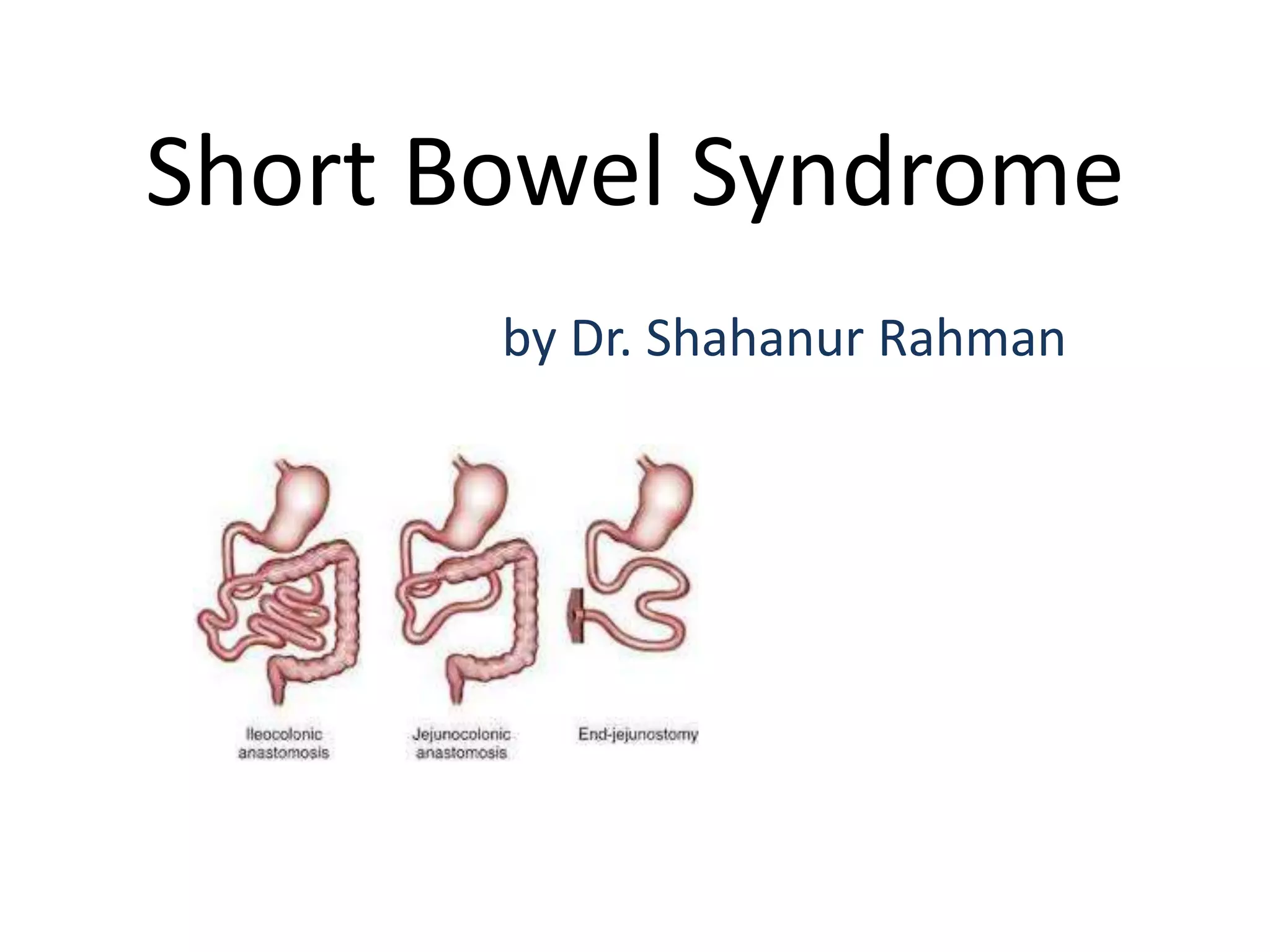 Short Bowel Syndrome | PPTX | Digestive Disorders | Diseases and Conditions
