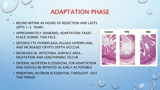 Short bowel syndrome | PPT