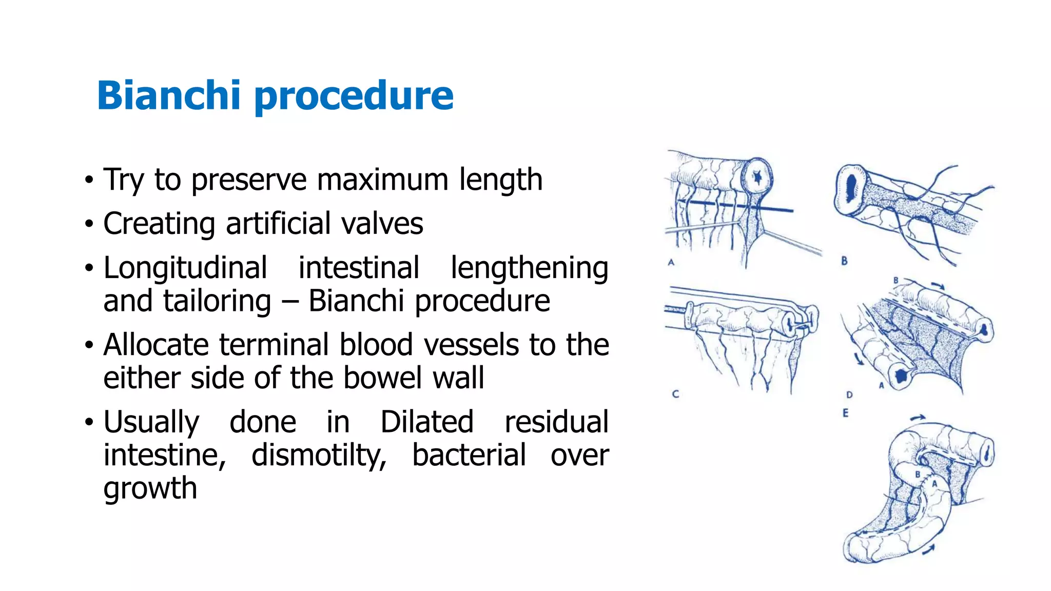 Short Bowel syndrome Dr Habibur Rahim | PPTX