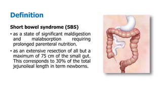 Short Bowel syndrome Dr Habibur Rahim | PPTX