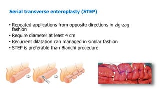 Short Bowel syndrome Dr Habibur Rahim | PPTX