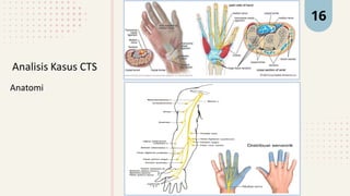 Short Case_Carpal tunnel Syndrome Case1.pdf