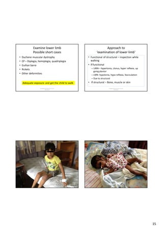 Short cases for final year MBBS Medical Student in Sri Lanka | PDF