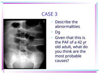 Basic exercises in radiology to help with diagnosis | PPT