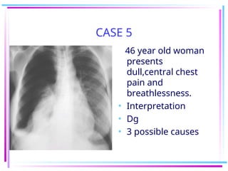 Basic exercises in radiology to help with diagnosis | PPT