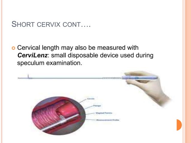SHORT CERVIX AND CERVICAL INSUFFICIENCY.pptx