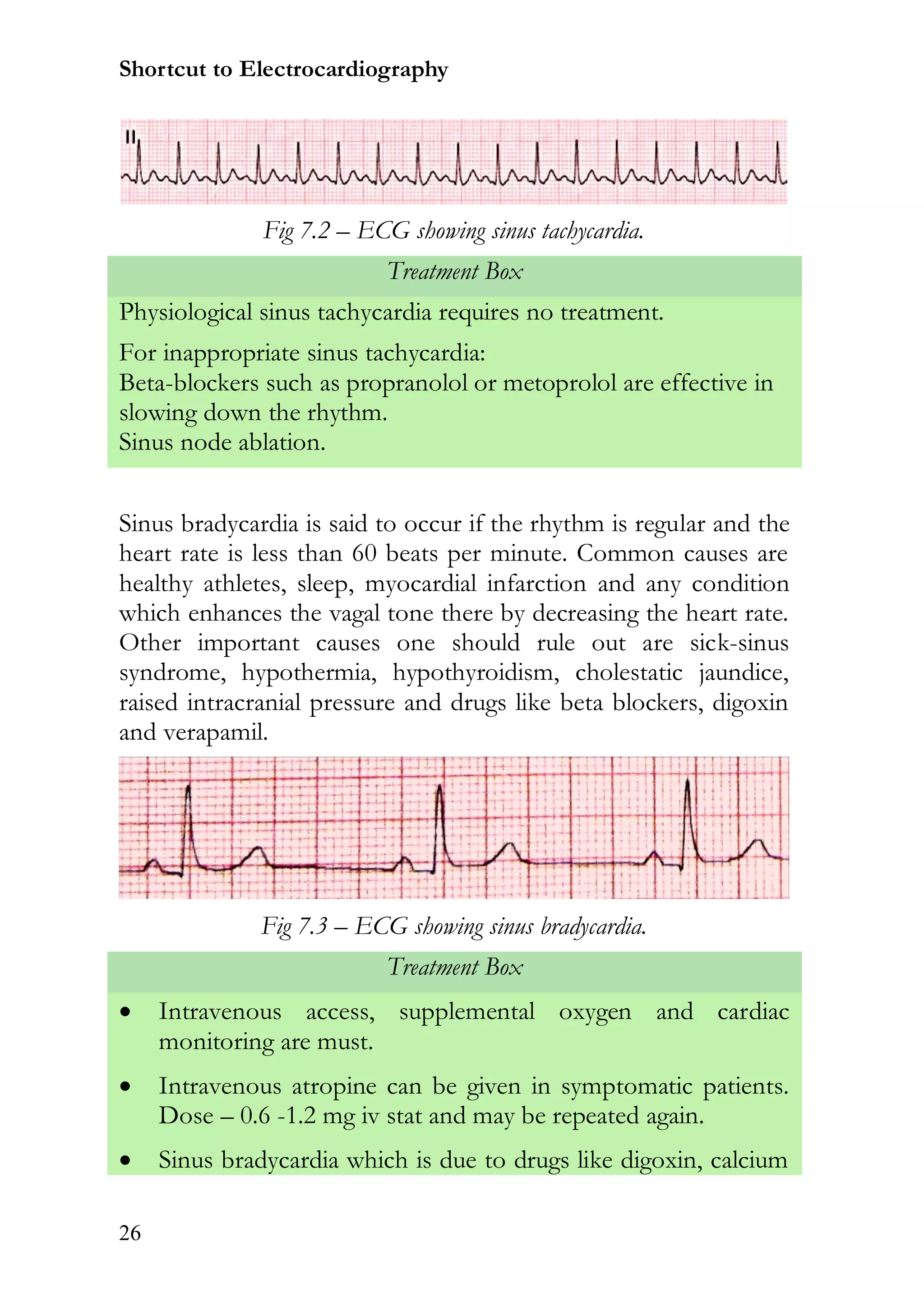 Shortcut to ECG | PDF
