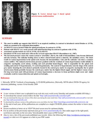 Short case...Spinal dural arteriovenous fistula withn congestive ...