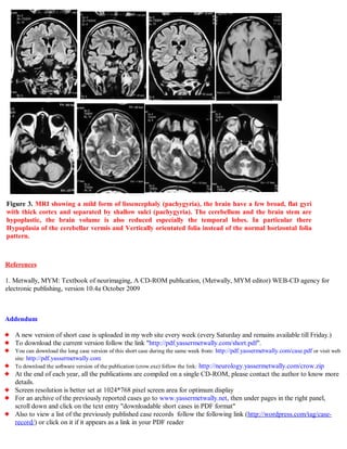 Short case...Cortical/cerebellar dysplasia | PDF | Brain and Nervous ...