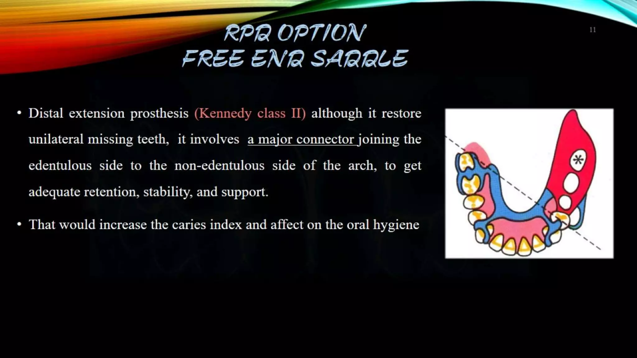 Shortened dental arch sda | PPTX