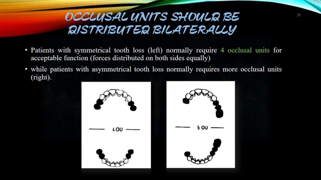 Shortened dental arch sda
