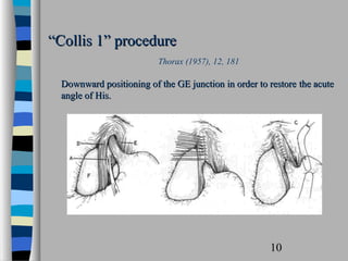 SECONDARY SHORT ESOPHAGUS DUE TO PROLONGED REFLUX | PPT | Free Download