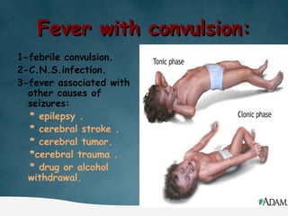 Short febril illness2016 new | PPT